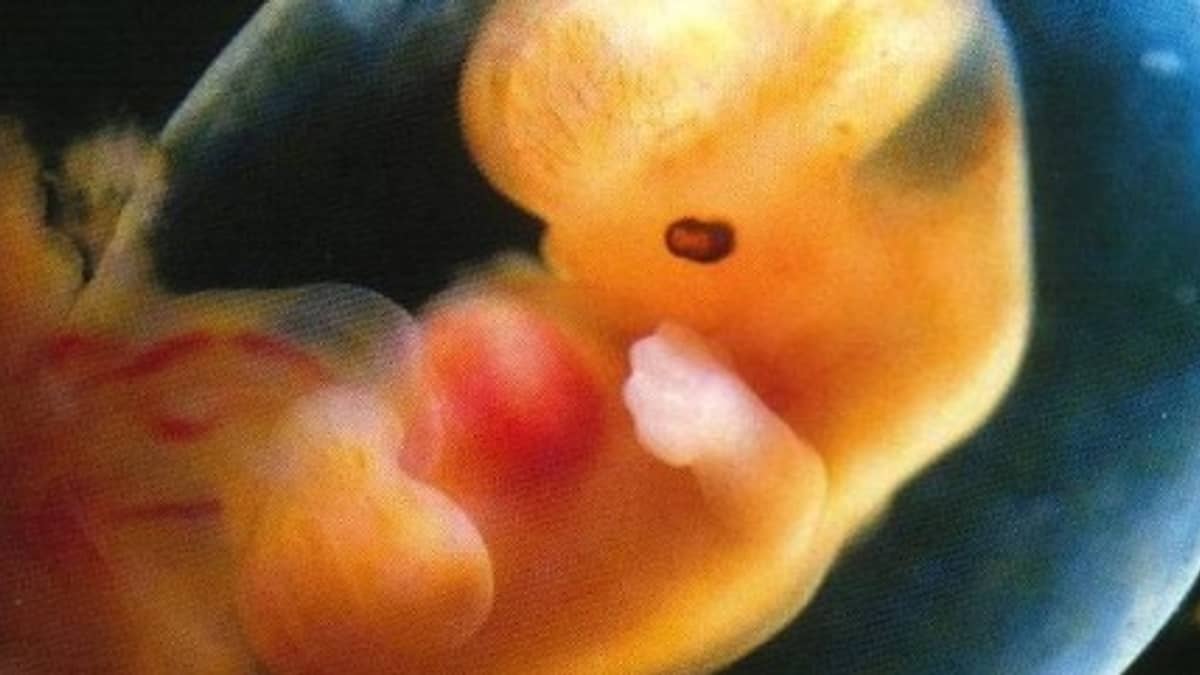 Embryo-on-a-chip | NPO Start